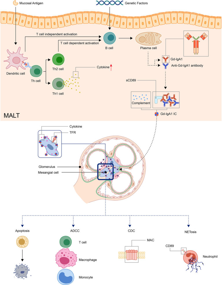 IgA肾病 – 谷禾健康