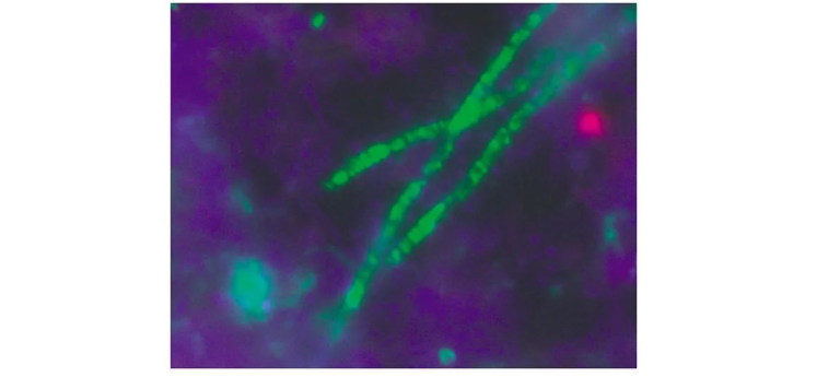 迷踪菌门 Elusimicrobia – 谷禾健康