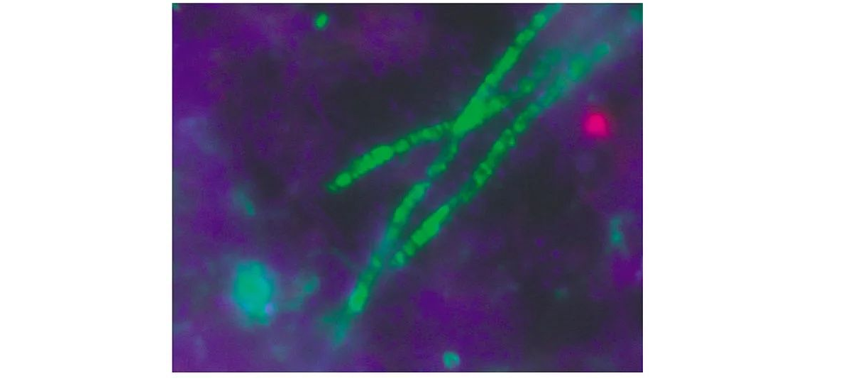脱铁杆菌门 Deferribacteres – 谷禾健康