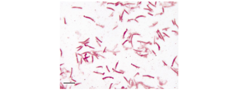 酸杆菌门 Acidobacteria – 谷禾健康