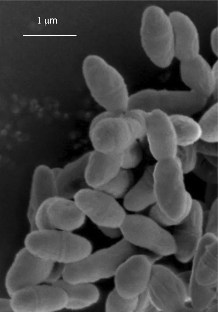 活泼瘤胃球菌（Ruminococcus gnavus）——多种疾病风险的潜在标志物 – 谷禾健康